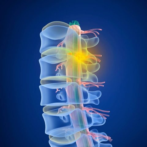 Back Pain – Understanding Your Diagnosis - Benefit Physiotherapy