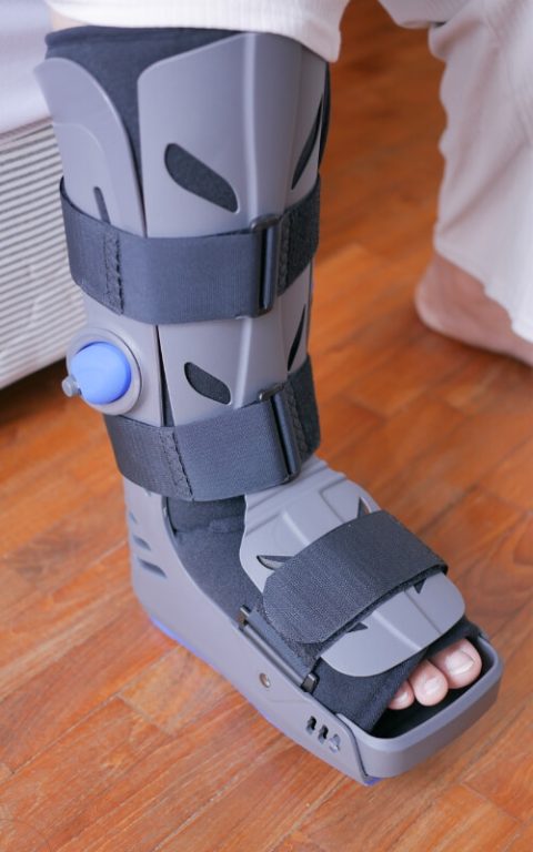 CAM Boots and their Uses in Rehabilitation of Foot and Ankle Injuries ...